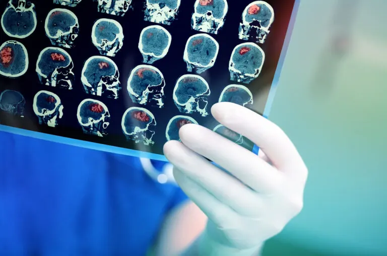 Radiography Salary in India | Dolphin PG College